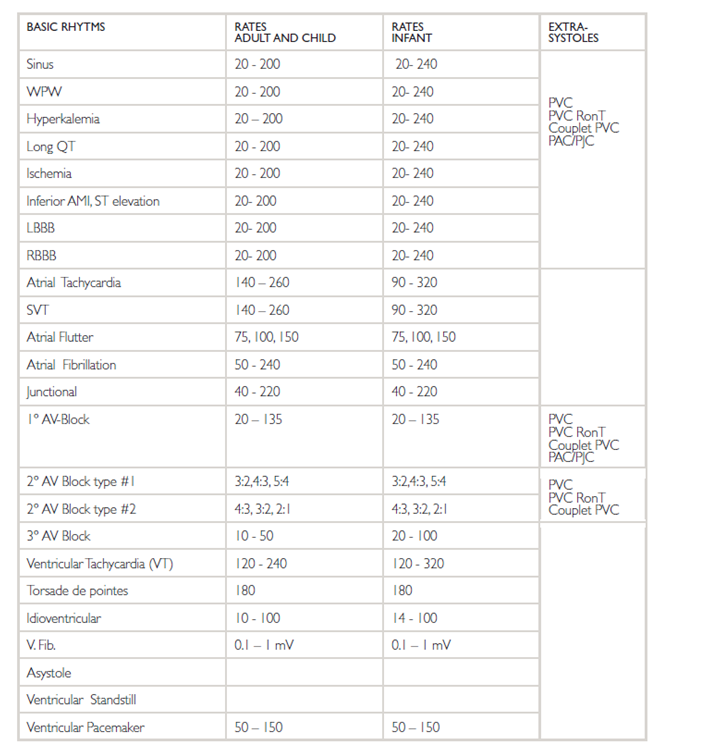 What ECG rhythms are available on the SimPad System?