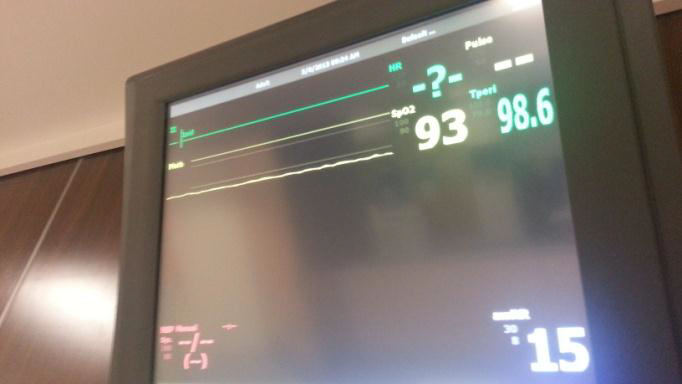 Why is my SimMan 3G's patient monitor losing the Heart Rate and SpO2 ...