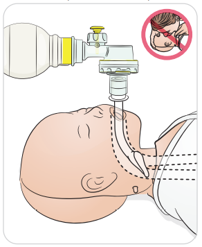 What types of intubation devices and methods does the Resusci Family ...