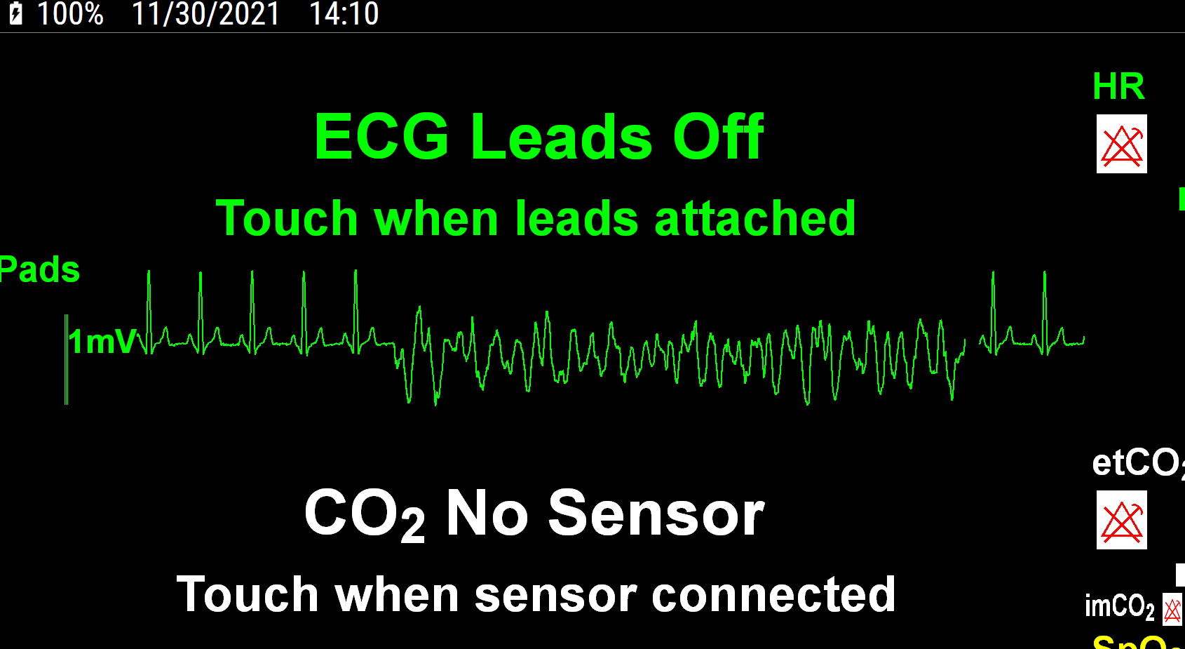 How is Defibrillator Monitor on LSH working?