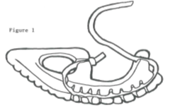 How to replace the spine tubing on Baby Stap?