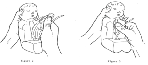 How to replace the spine tubing on Baby Stap?