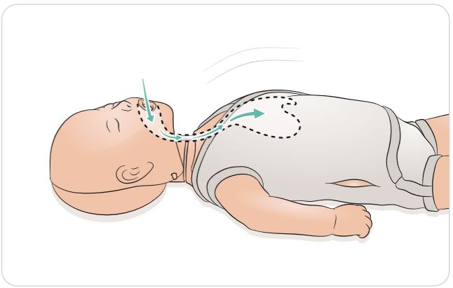 What are the open Airway angles for Little Baby QCPR?