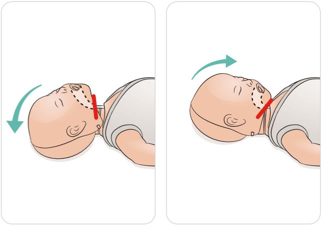 What are the open Airway angles for Little Baby QCPR?